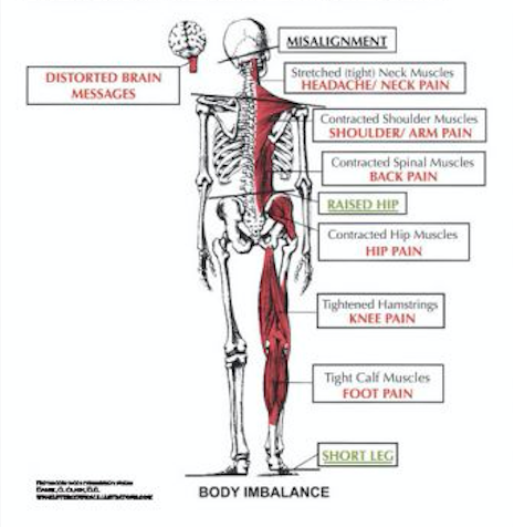 Body Balance | Upper Cervical Care
