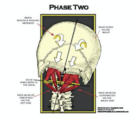 Cervical Contractions