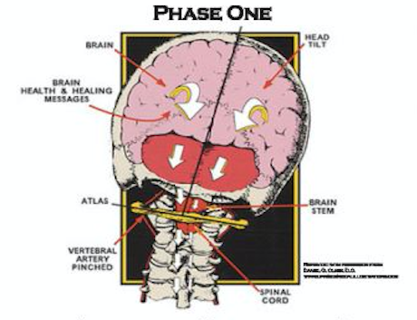 Cervical Contractions